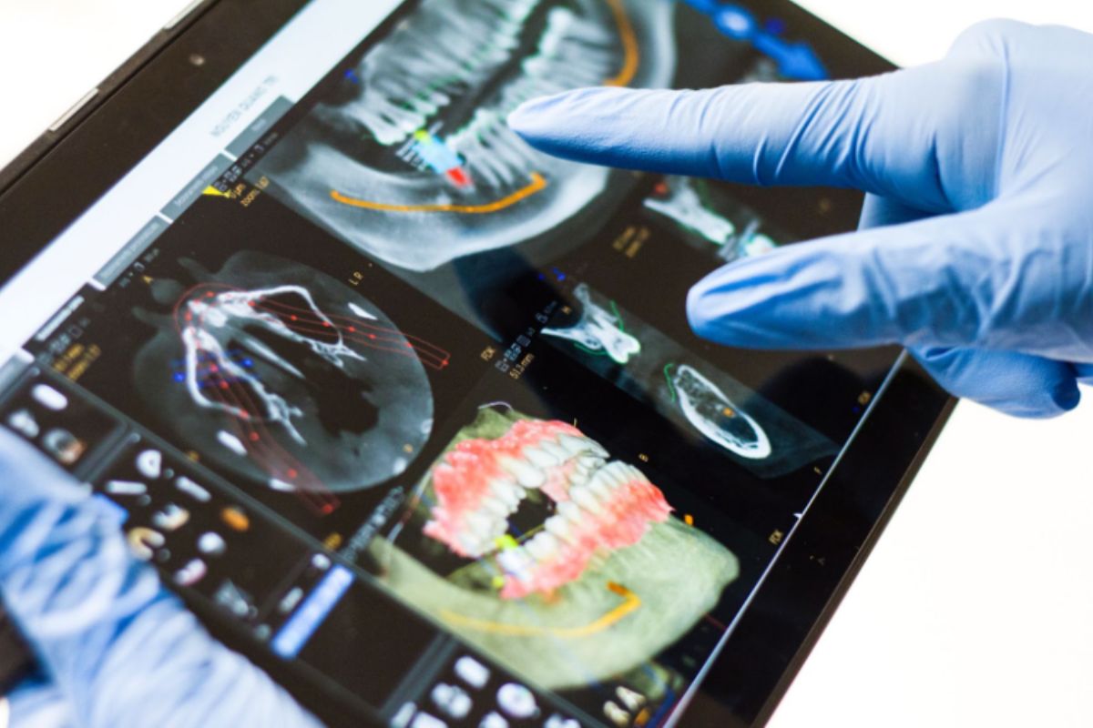 How is AI used in dentistry? Advantages? Dentist replacement?